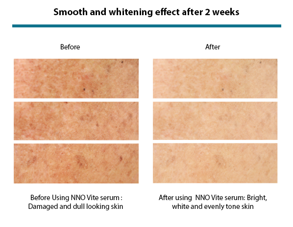 Buy Skin Care Products with Natural Ingredients - NNO VITE