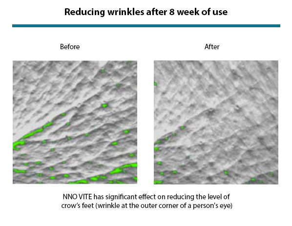 Buy Skin Care Products with Natural Ingredients - NNO VITE